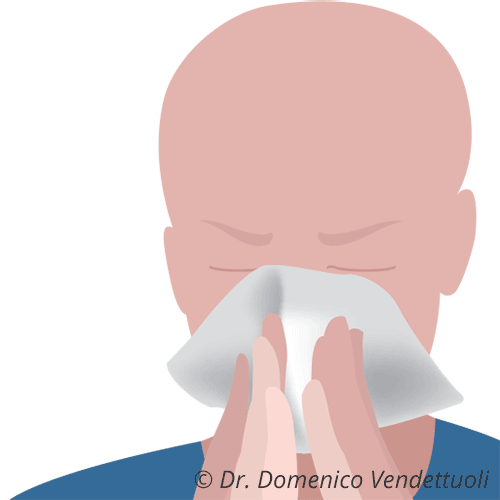 Tiroidite - Dr. Domenico Vendettuoli